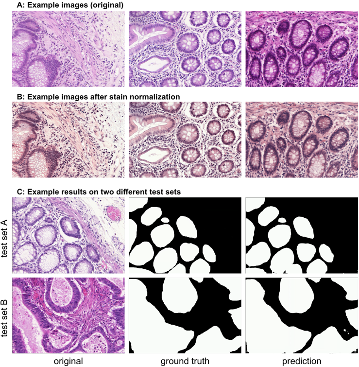 MMV_Im2Im: An Open Source Microscopy Machine Vision Toolbox for Image ...