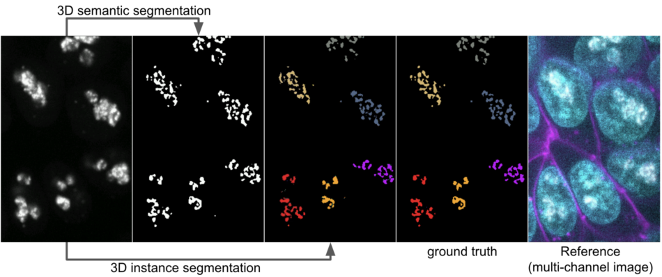 MMV_Im2Im: An Open Source Microscopy Machine Vision Toolbox for Image ...